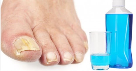 10 Weird Home Remedies That Actually Work - Wise Thinks