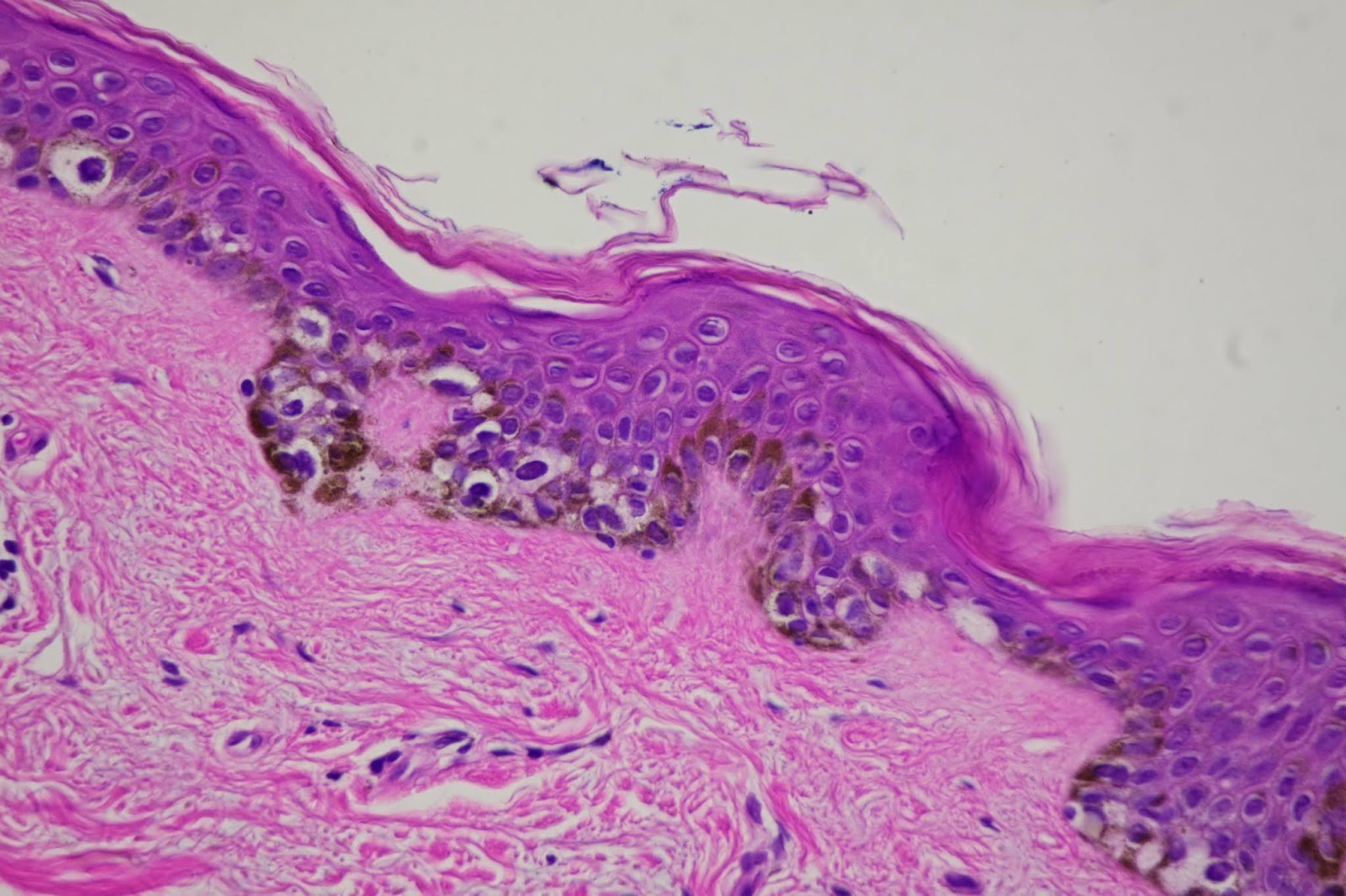 Consultations in Dermatopathology