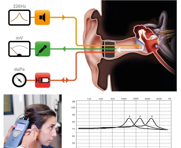 Medical Terms & Сlinical Сases : Impedance audiometry