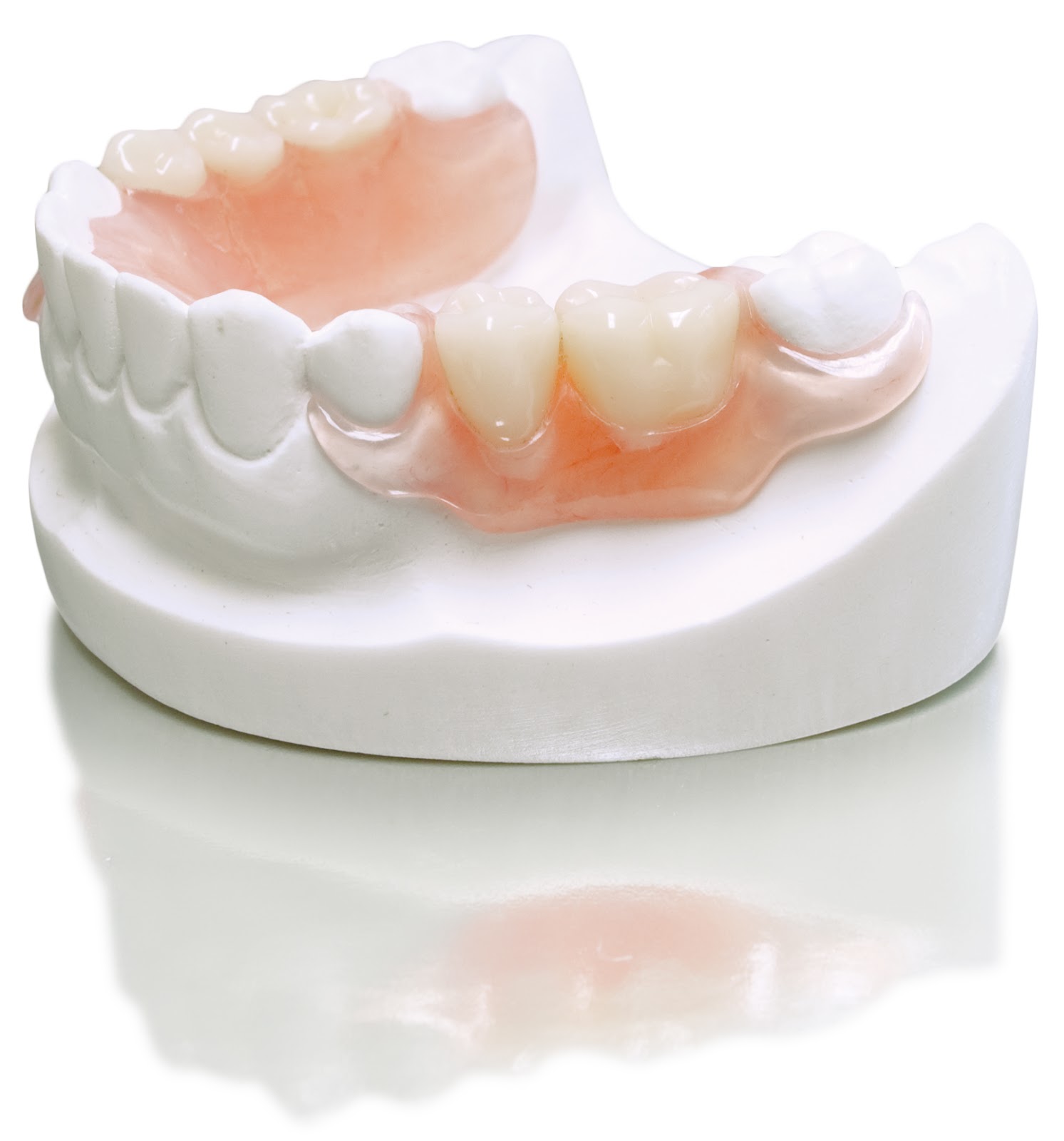 valsdentallab: Flexible Dentures