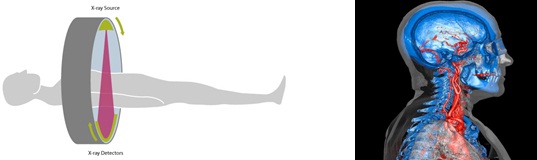 Image Processing - Image sources: X-ray Imaging