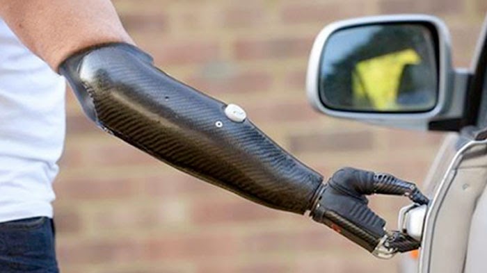 lapaginadebetobuzali: PRÓTESIS INTELIGENTE