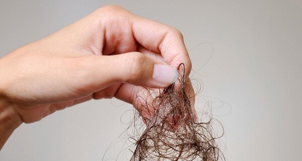 On average, losing how many strands of hair a day is normal?