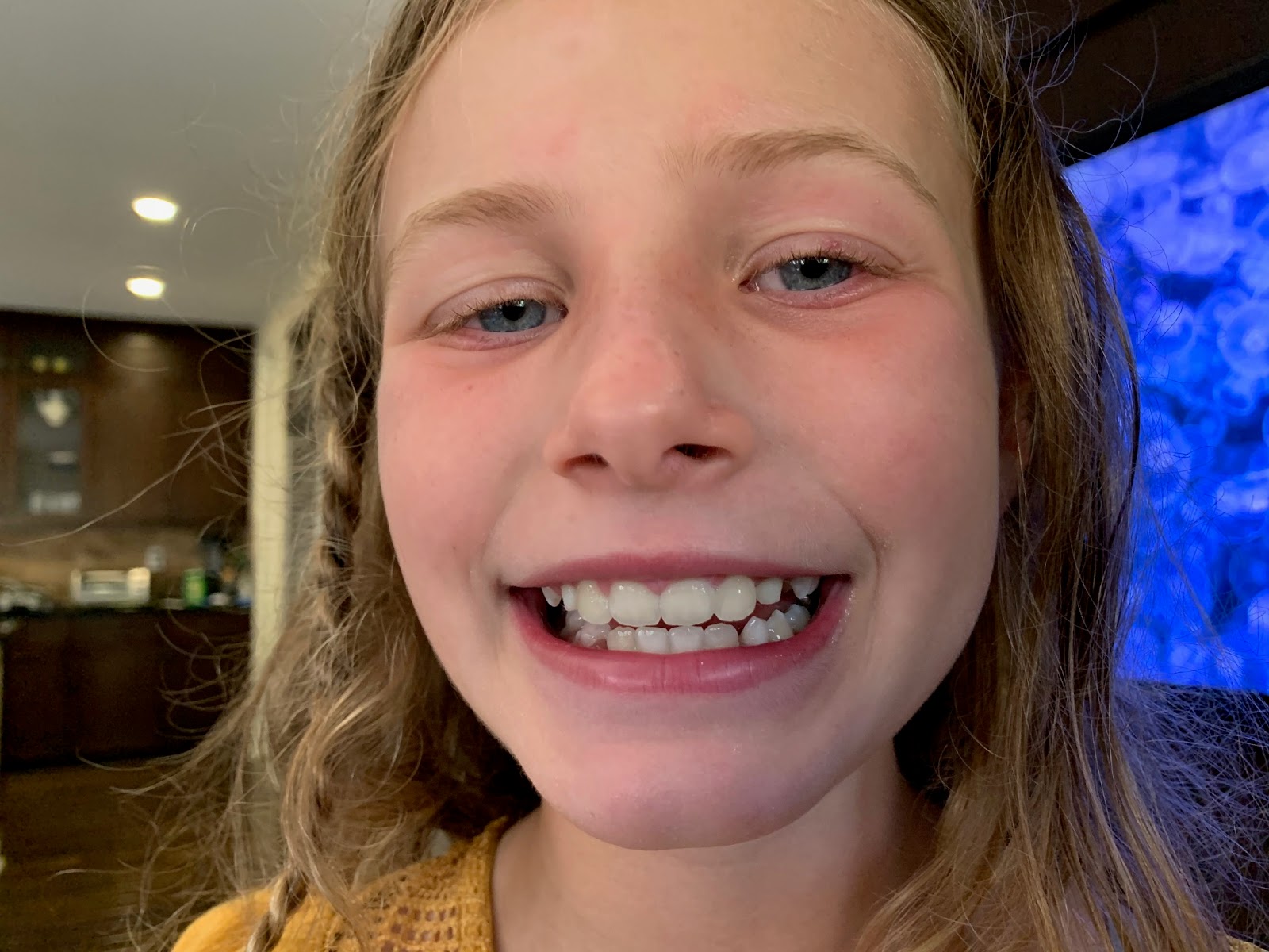 The Life and Times of Matt, Darcy, Ellie, Emily, and Wyatt: Braces Off!