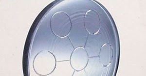 The BIG Picture: The Difference Between The Amezcua Bio Disc and Bio Disc 2