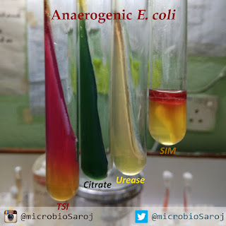 MICROBIOLOGY BLOG FOR STUDENTS (MBLOGSTU): Cultural and Biochemical ...