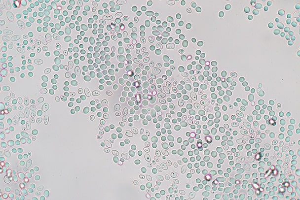 Morfología de los hongos.