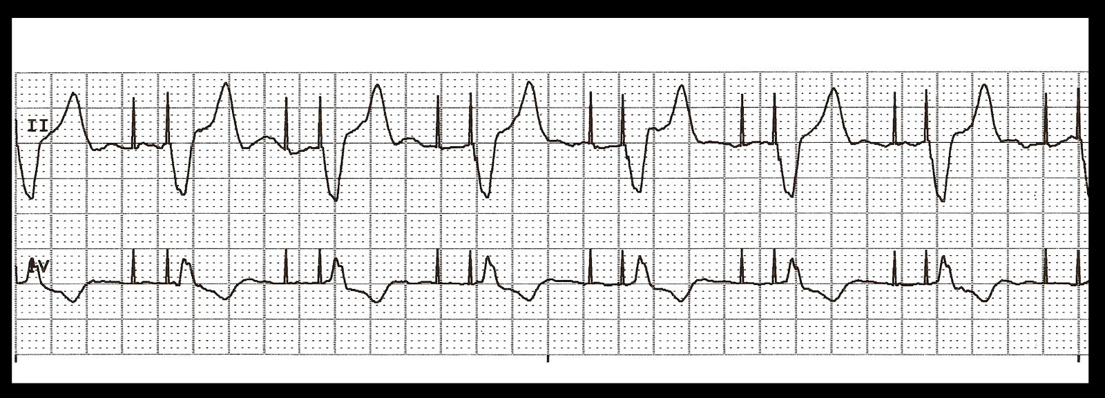 Practice EKG Strips 359