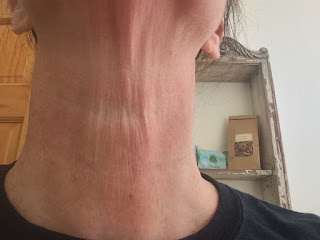 I Feel Bad About My Neck!! | Now Choose Life