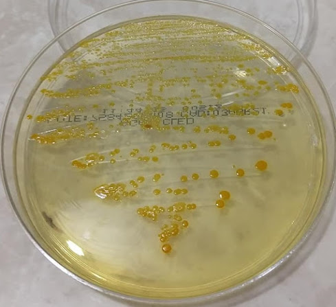 Bioquímica Diagnóstica BQD-YAI: Escherichia coli