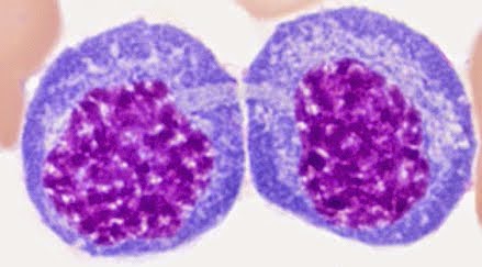 Fichero de Hematología Heber Mayén: Proeritroblasto basófilo.