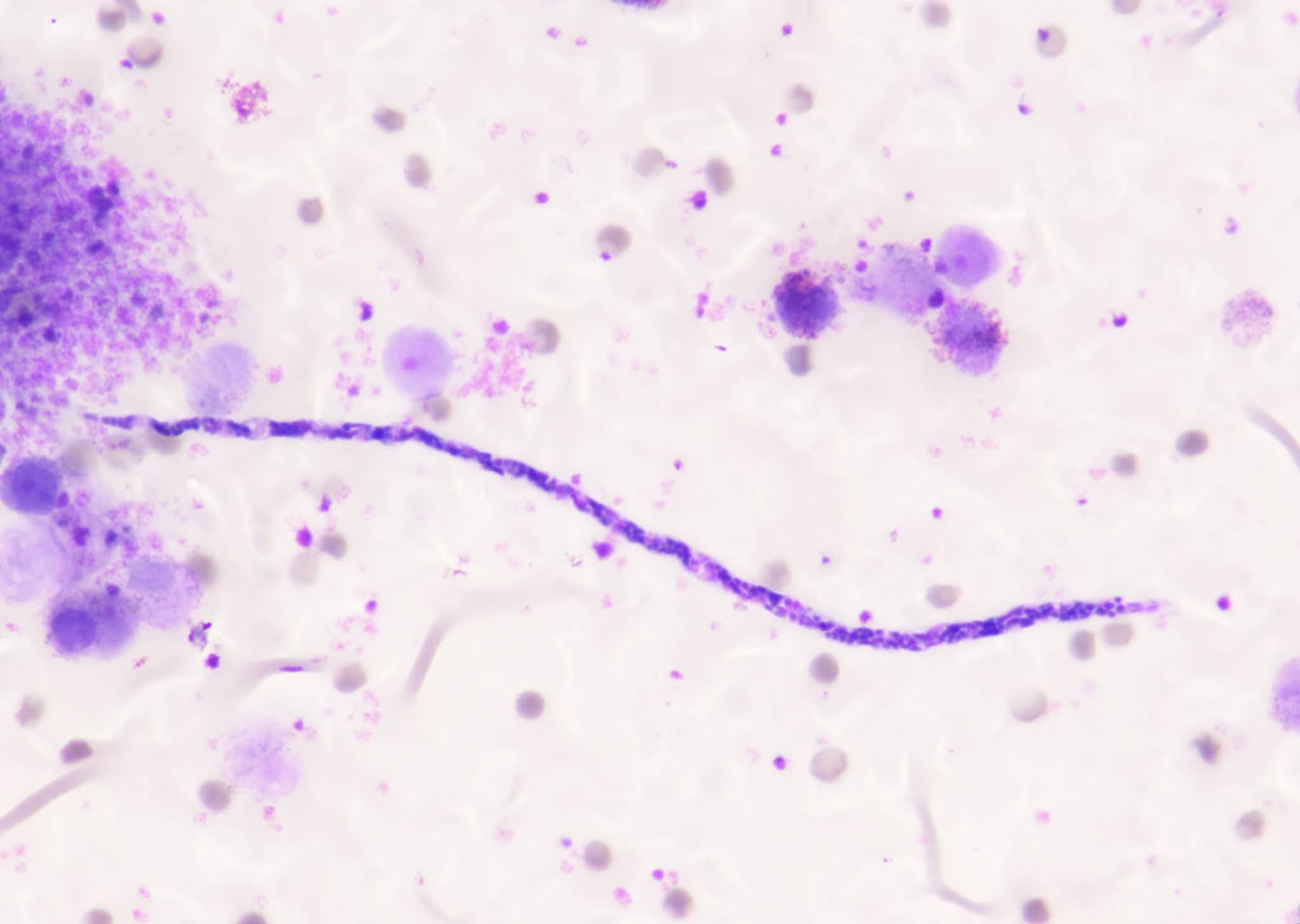 Creepy Dreadful Wonderful Parasites: Case of the Week 661