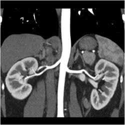 CROSS-SECTIONAL IMAGING EDUCATION HUB: CT Angiography ...Understanding ...