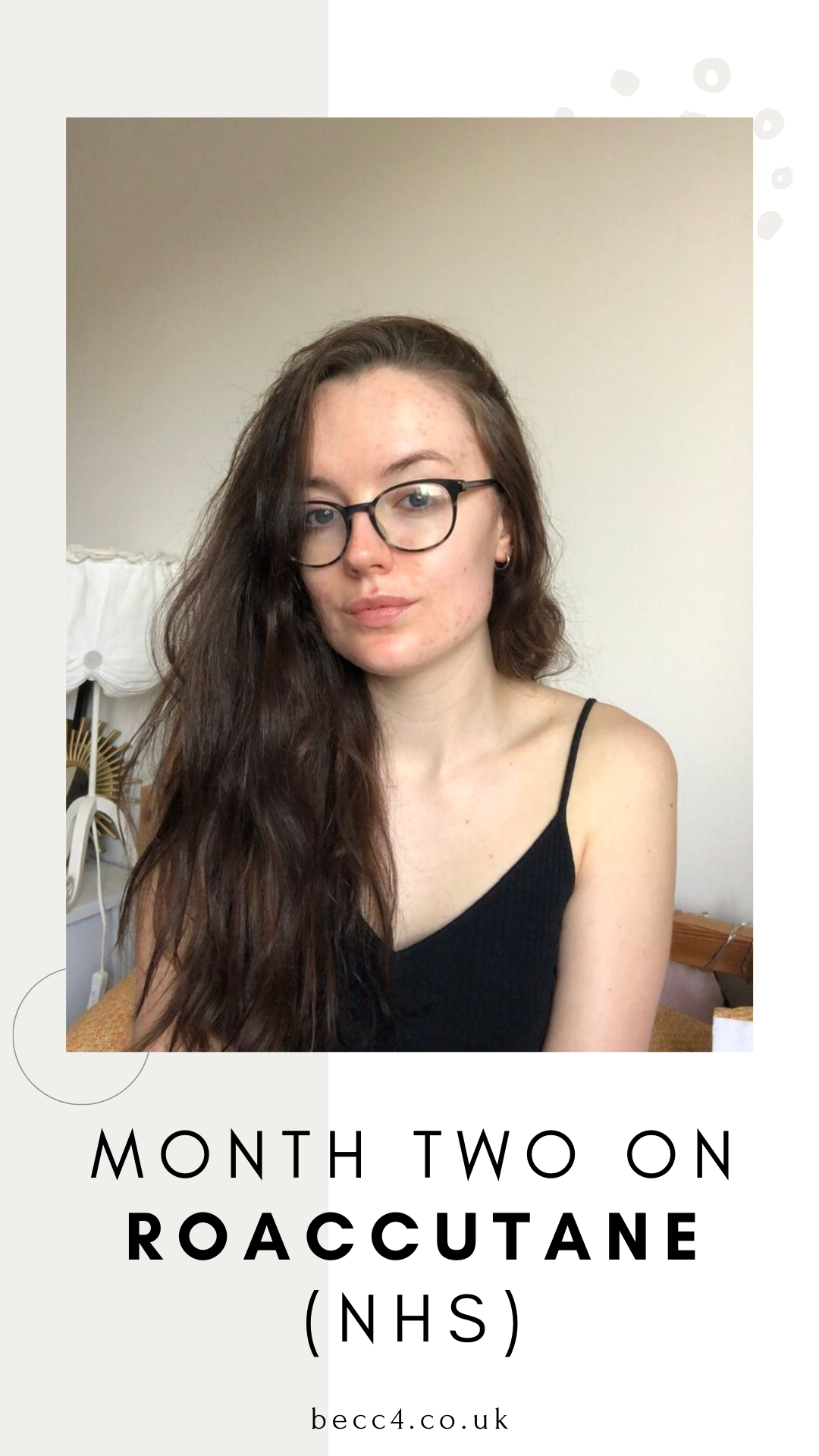 Month Two On Roaccutane (NHS) | becc4 / A Salisbury Food and Lifestyle Blog