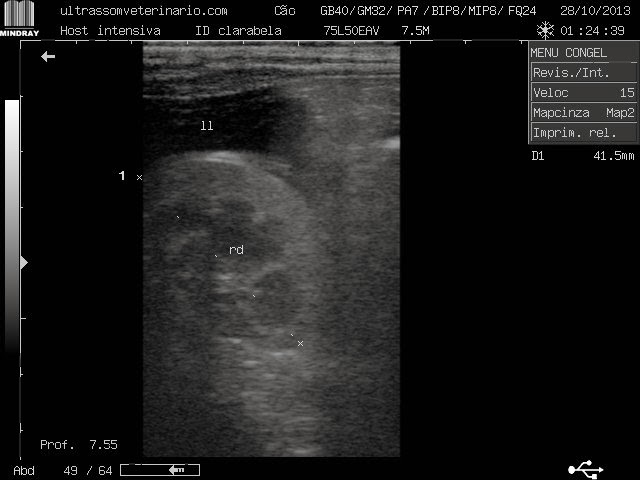 Emergências: a importância da ultrassonografia