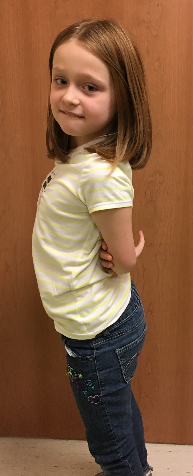 Ulnar Deficiency Follow Up | Congenital Hand and Arm Differences ...