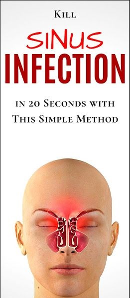 Kill Sinus Infection in 20 Seconds with This Simple Method - wellness days