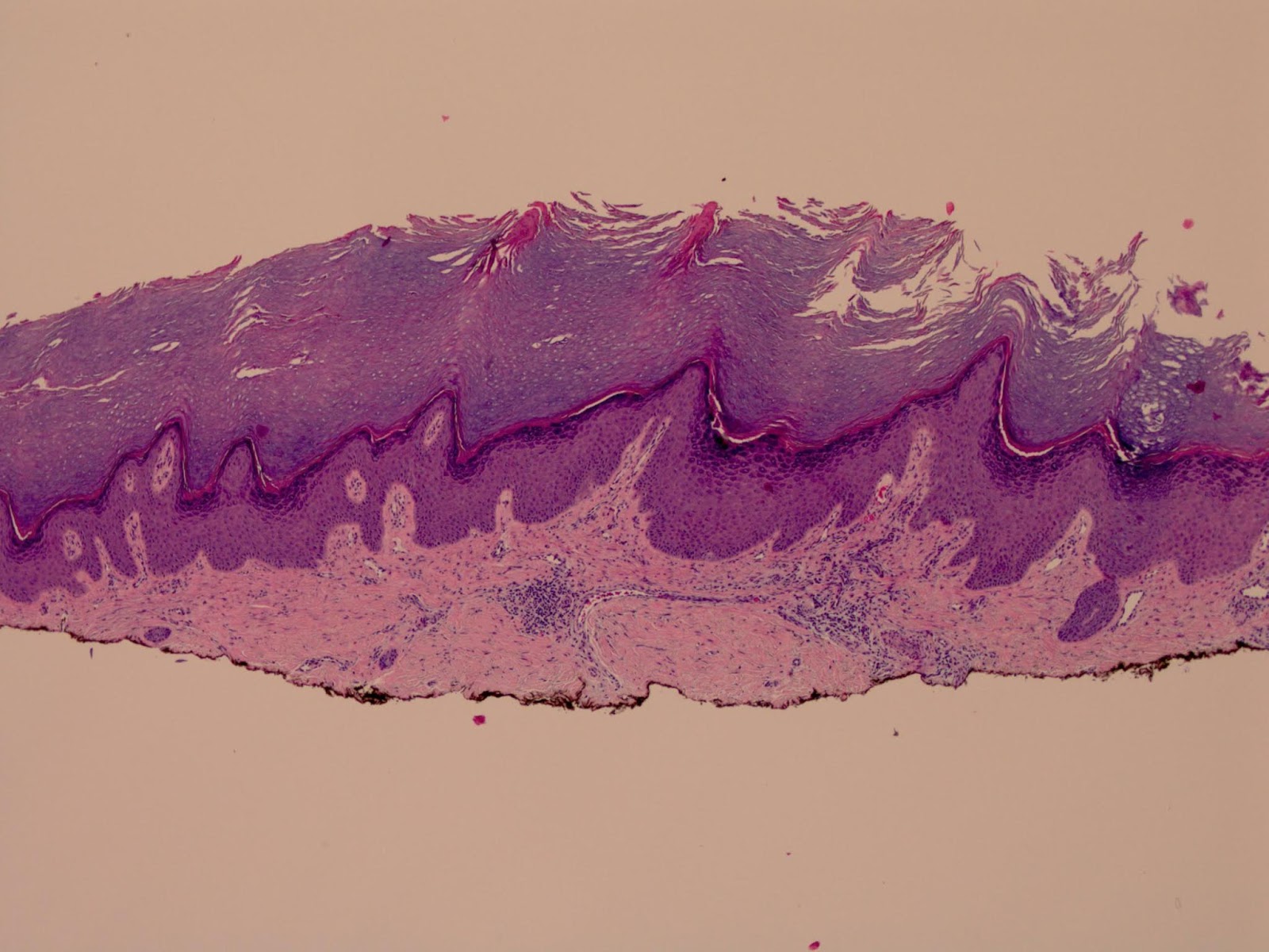 EL RINCÓN DE LA MEDICINA INTERNA. juanpedromacaluso@yahoo.com.ar ...
