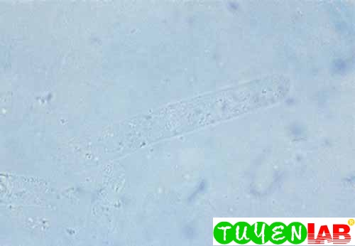 Atlas of Casts in urine | Free Medical Atlas