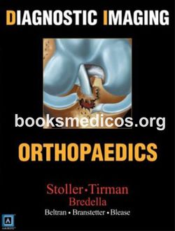 Diagnostic Imaging Orthopaedics Stoller 1st Edition | booksmedicos