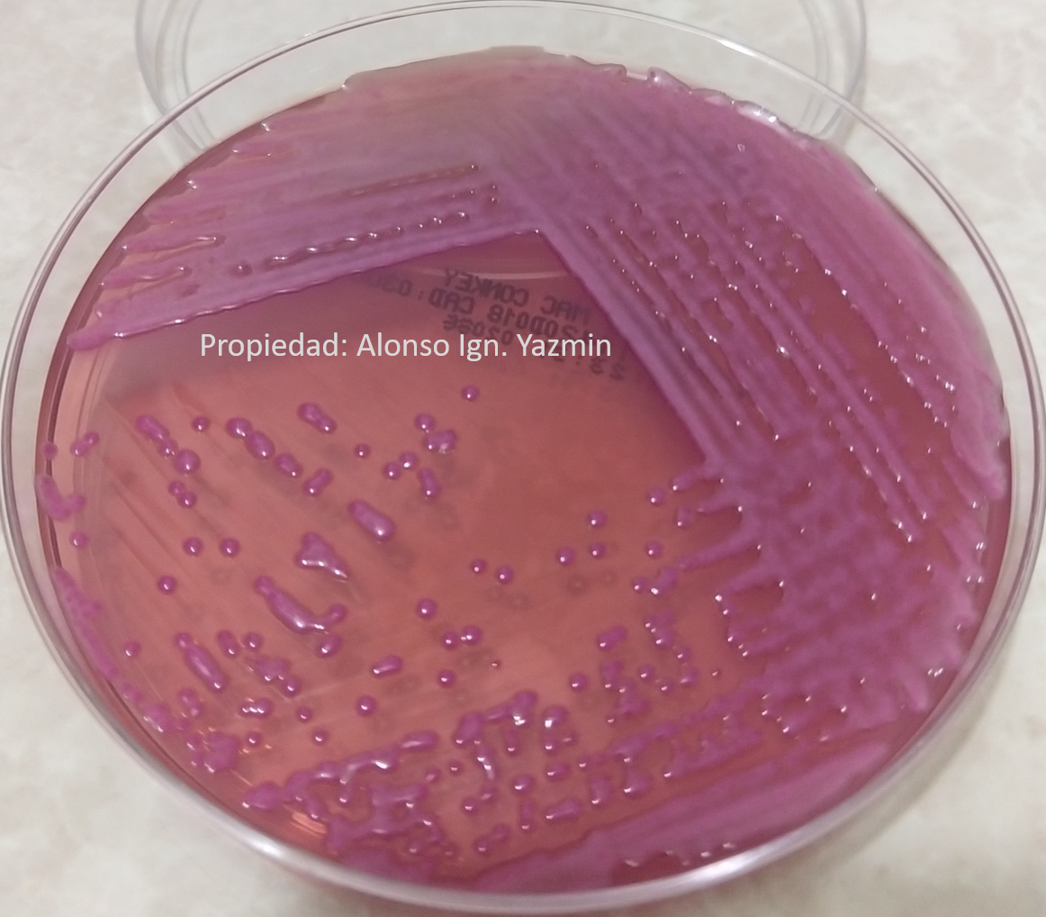 Bioquímica Diagnóstica BQD-YAI: Enterobacter cloacae