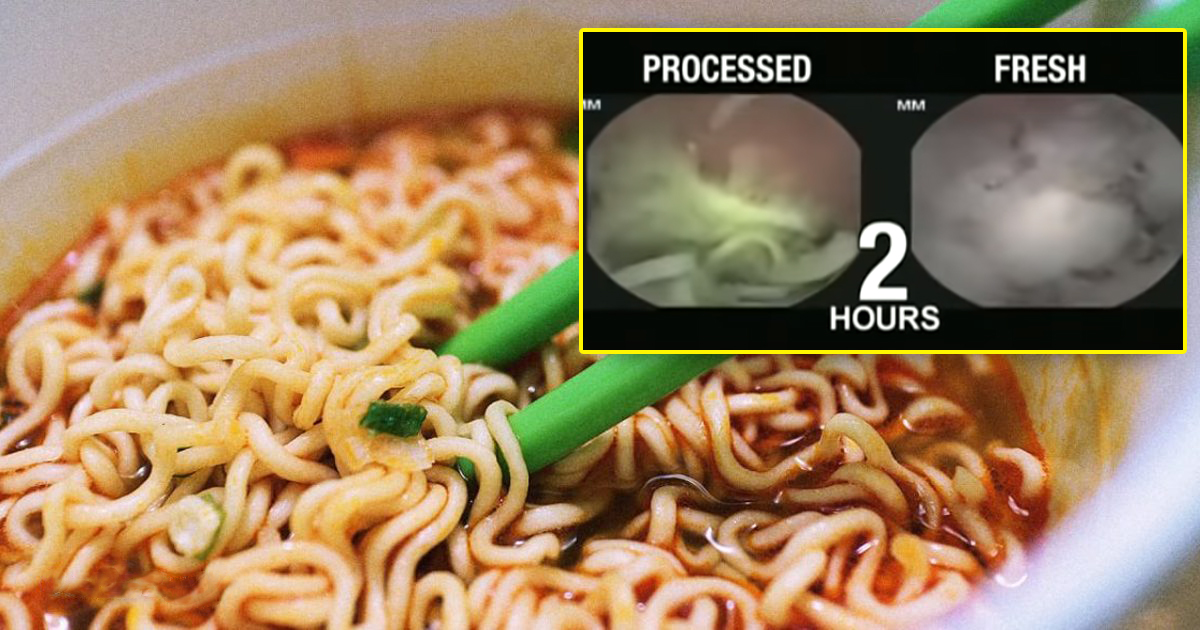 BioLogic: Instant noodles bad or good for health?
