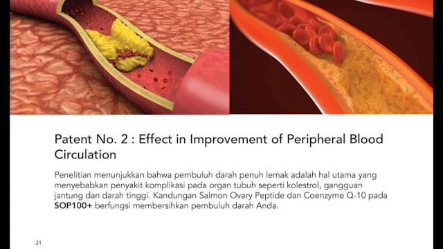 APA PATENT DAN FUNGSI SOP SUBARASHI - BISNIS AFC RAMSINA - Perusahan ...