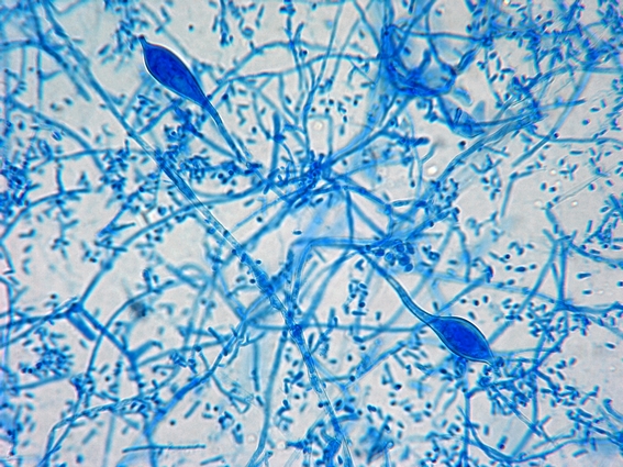 Fun With Microbiology (What's Buggin' You?): Microsporum audouinii