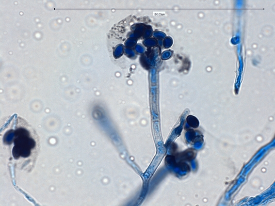 Fun With Microbiology (What's Buggin' You?): Stachybotrys species