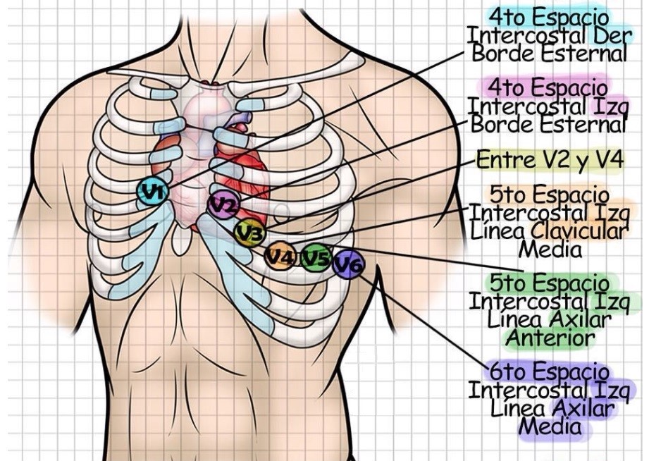 Técnicas y procedimientos de Enfermería: ELECTROCARDIOGRAMA (I ...