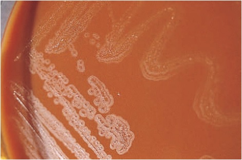 [Microbiology] Atlas of Haemophilus and Other Fastidious Gram-Negative ...