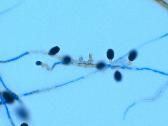 Fun With Microbiology (What's Buggin' You?): Pithomyces species