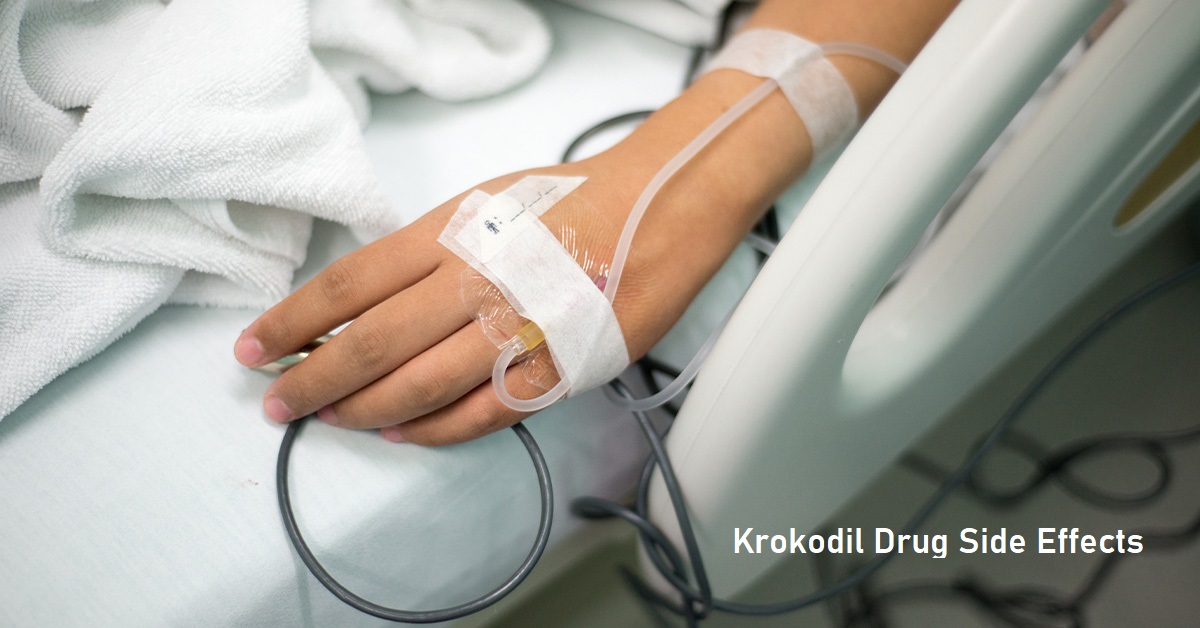 Krokodil Drug Fact : Opioid with Toxic Side Effects