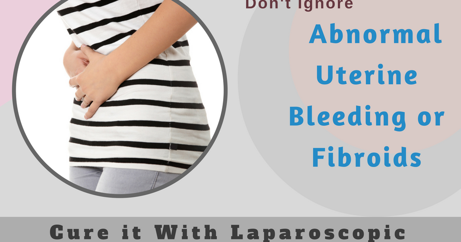 Laparoscopic Surgery: Laparoscopic Hysterectomy – Simplifying Uterus ...