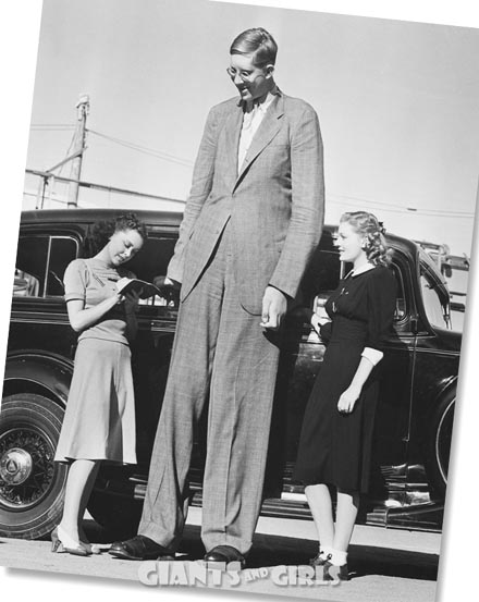 Pituitary: Gigantism Pituitary