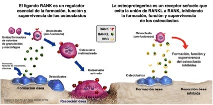 Salud Osteoarticular: El sistema RANK-RANKL-OPG.