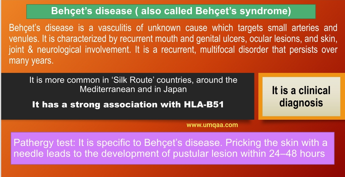 What are the diagnostic criteria for Behçet’s disease?
