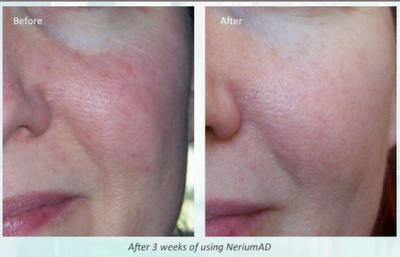 Keep Calm With Nerium: Nerium---Picture Time!