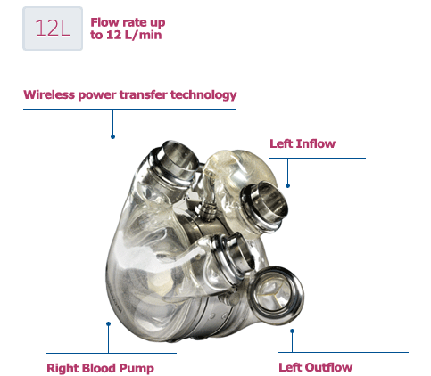 Total Artificial Hearts..Have one? Let's talk!: AbioCor