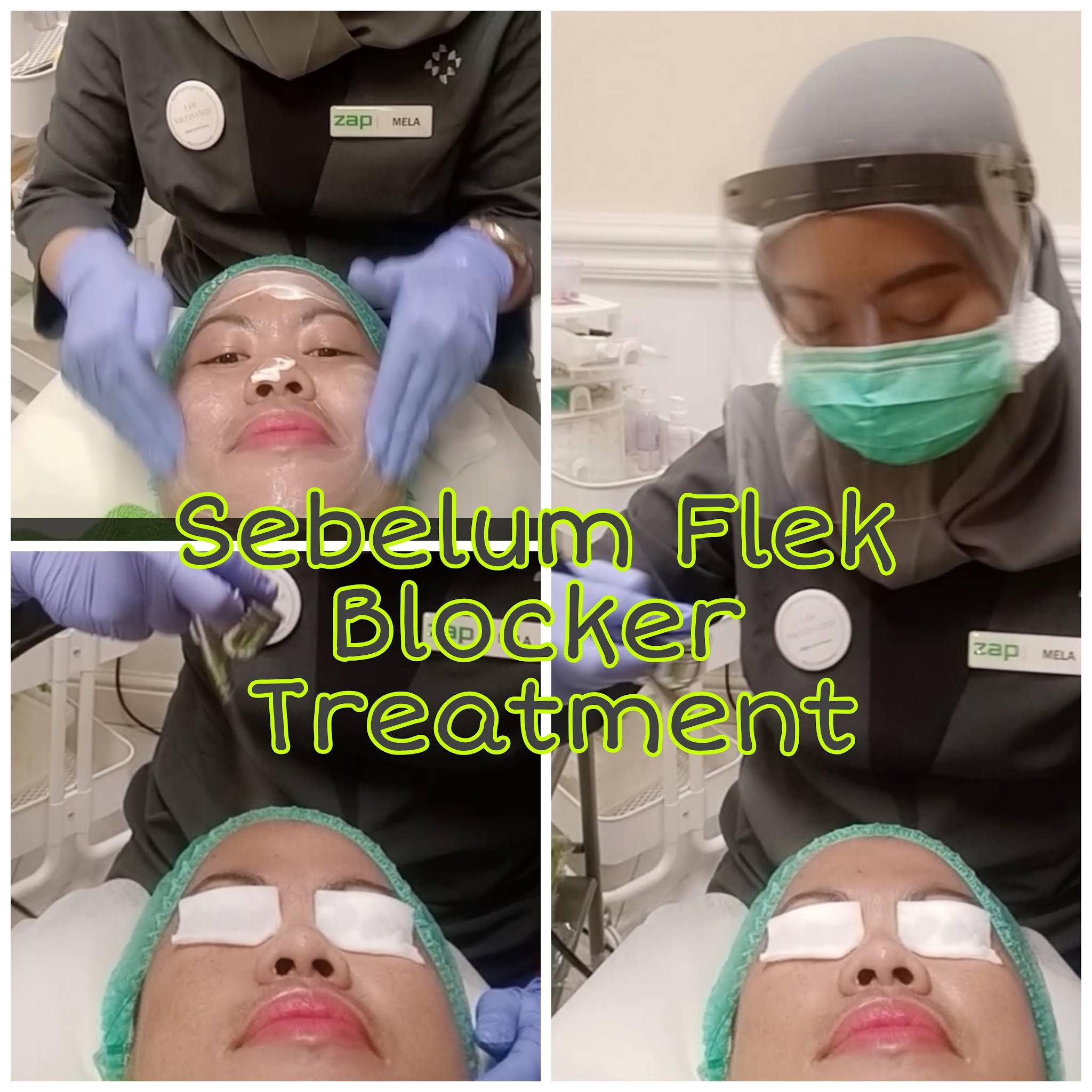 Flek Blocker Treatment ZAP Clinic Ampuh Cegah Flek Hitam Usia 40 Tahun
