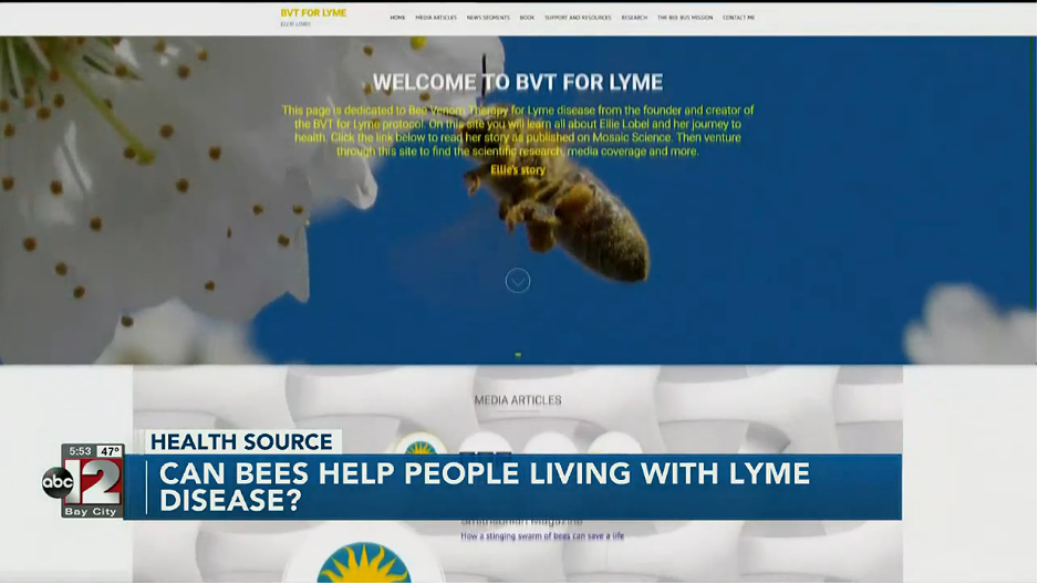 Apitherapy News: Using Bee Venom as a Treatment for Lyme Disease