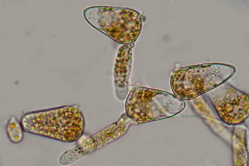 El mundo microscópico de los hongos: Gymnosporangium clavariiforme ...