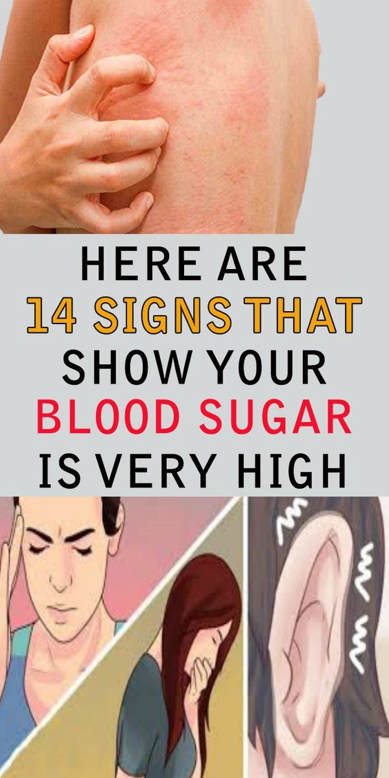 14 Signs Showing That Your Blood Sugar Is Very High Healthy Lifestyle 14-signs-showing-that-your-blood-sugar-is-very-high-healthy-lifestyle