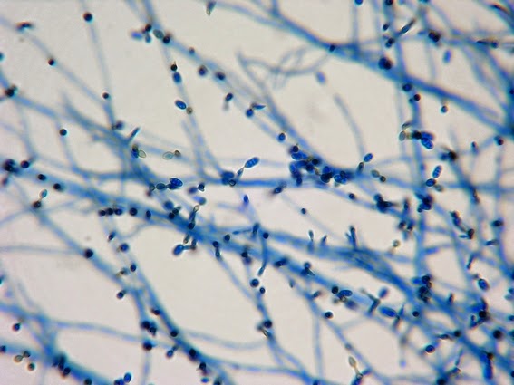 Fun With Microbiology (What's Buggin' You?): Ochroconis species