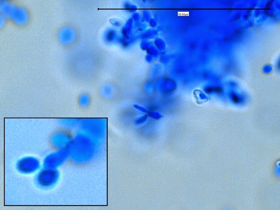 Fun With Microbiology (What's Buggin' You?): Sporothrix schenckii ...