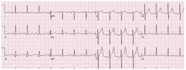 ER goldbook: EKG interpretation