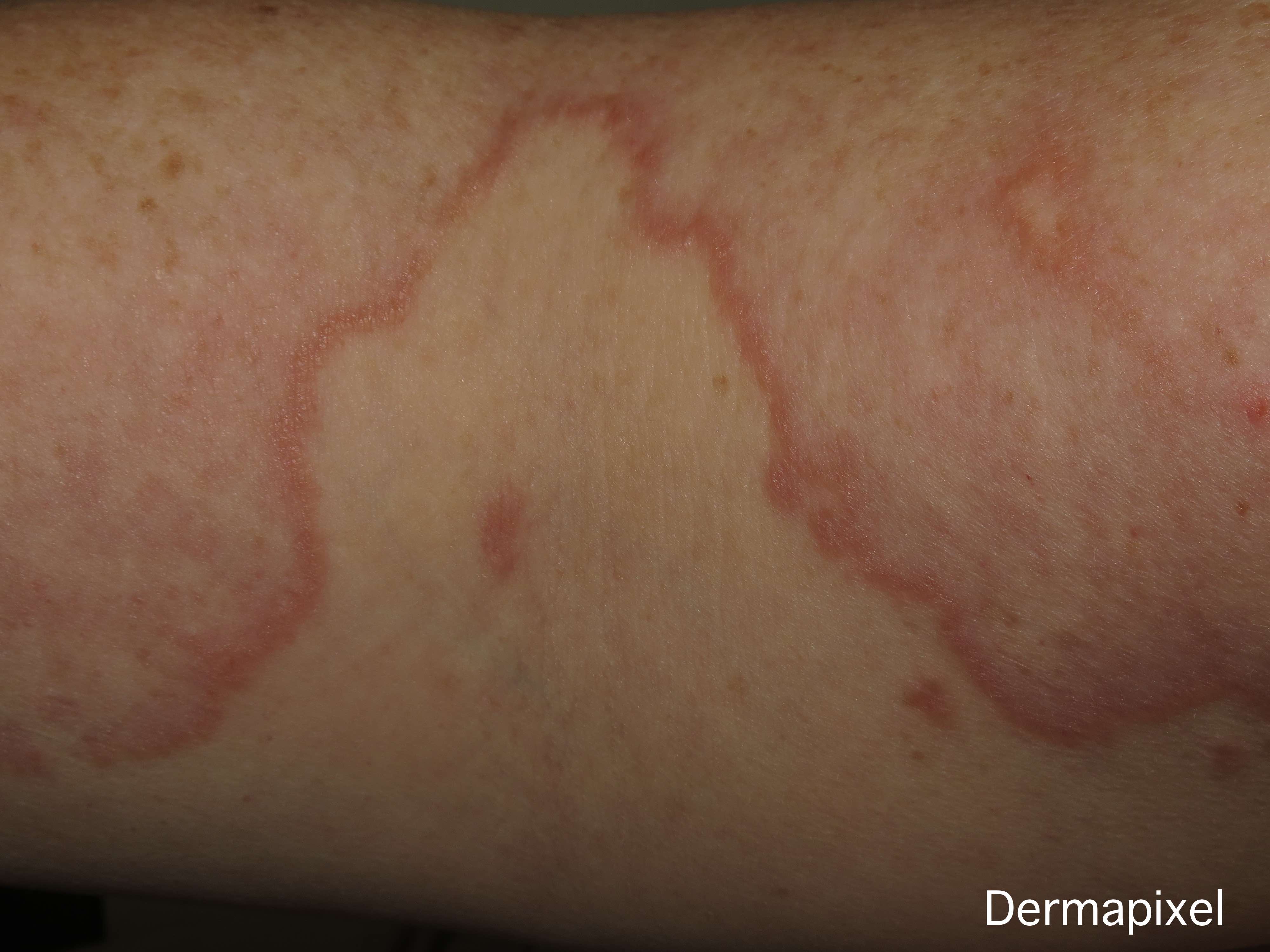 Dermapixel: junio 2021