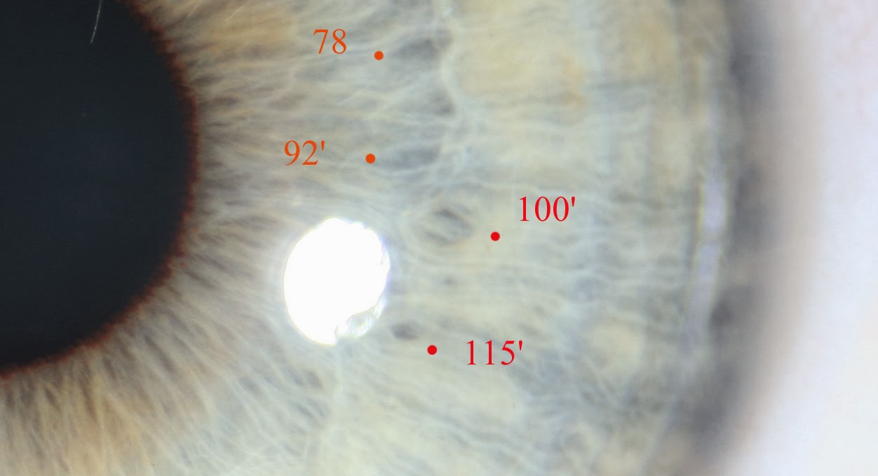 Modern & Multidimensional Iridology: Multidimensional Iridology on ...