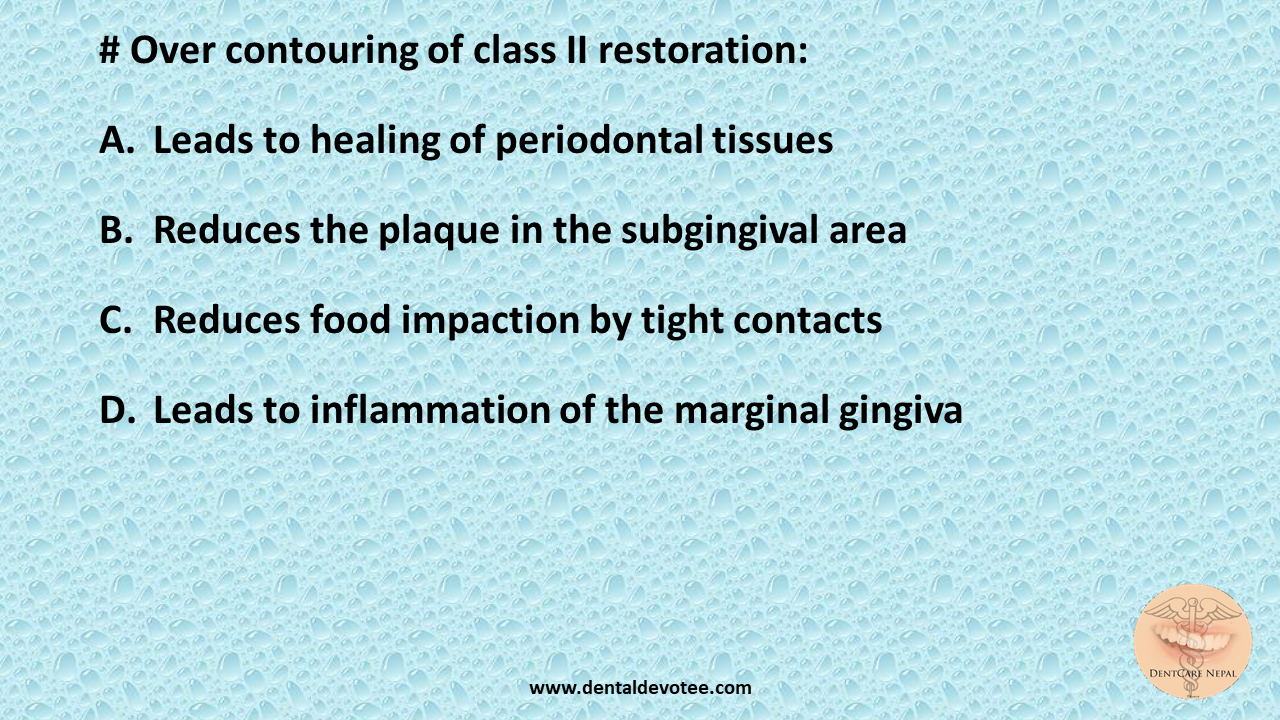 Dentosphere : World of Dentistry: Over contouring of class II restoration: