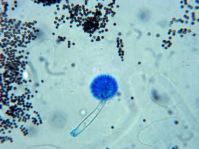 Aspergillus niger Caracteristic - AGROTEKNO LAB